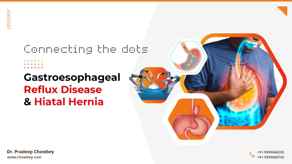 Dr. Chowbey - Gastroesophageal Reflux Disease and Hiatal Hernia Treatment